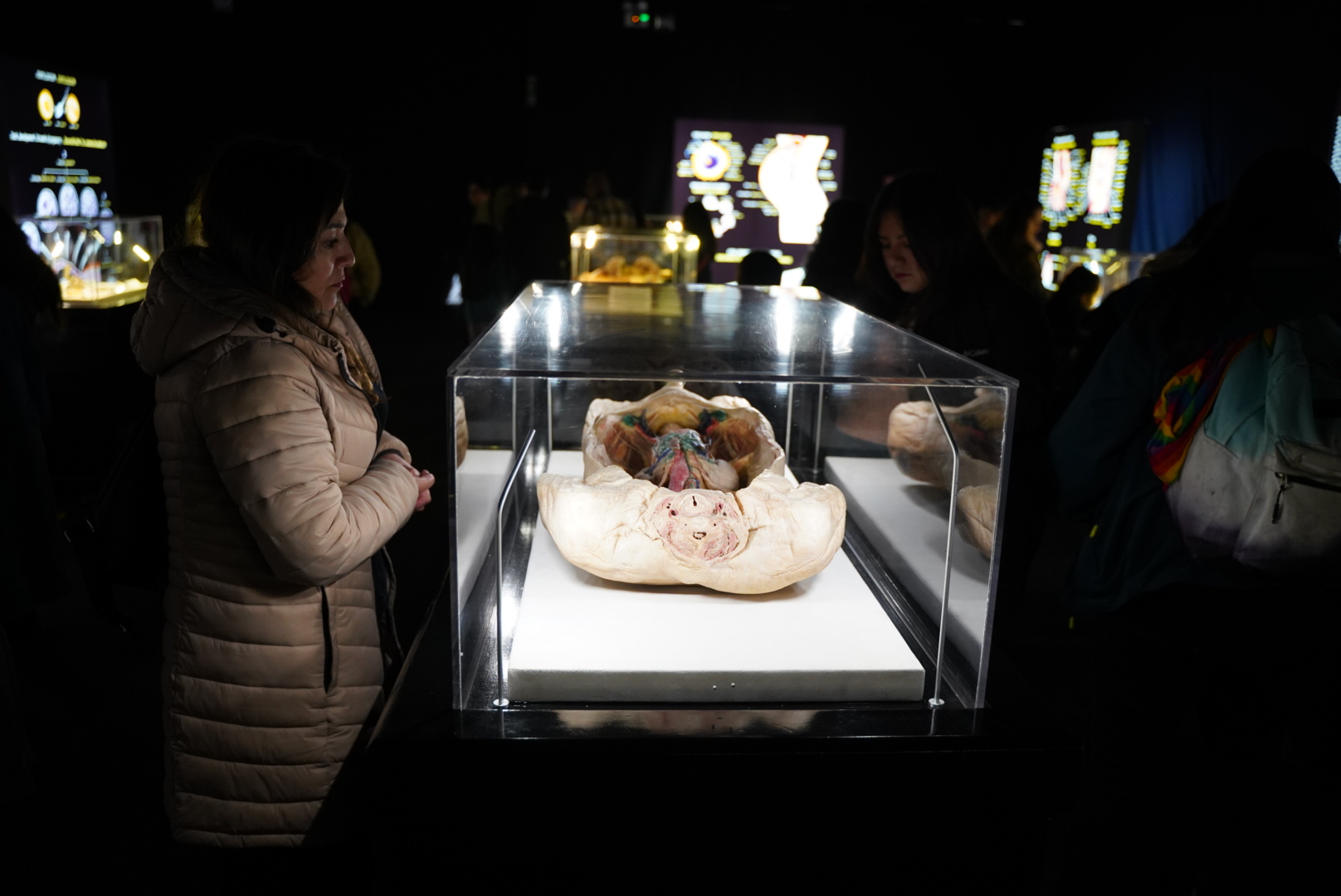 Bodies Evolution en Concepción: Todo lo que tienes que saber